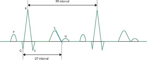 The Qt Interval Prolongation Potential Of Anticancer And Supportive Drugs A Comprehensive