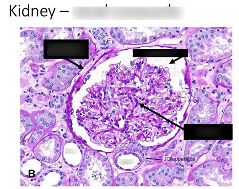 Renal Corpuscle Diagram Quizlet