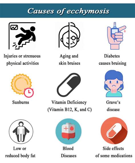 Ecchymosis Definition Symptoms Causes And Treatments