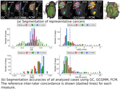 Performance Of Segmentation Methods A Example Segmentations Produced
