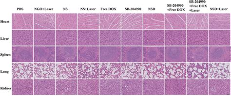 A Graphene Based Lipid Modulation Nanoplatform For Synergetic Lipid St