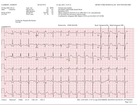 St Elevation Rreadmyecg