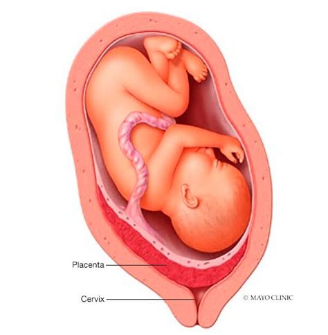 Difference Between Placenta And Umbilical Cord
