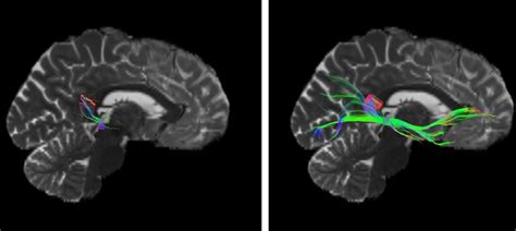 Research Hengameh Mirzaalian