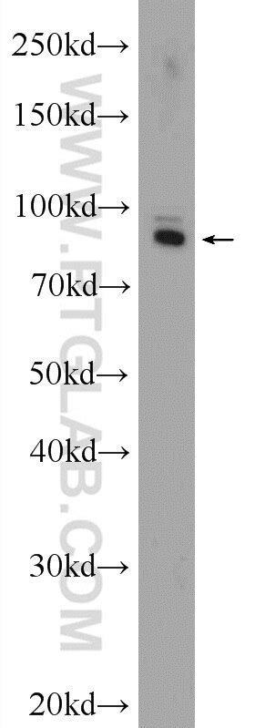 Glasteaat1 Antibody 20785 1 Ap Proteintech