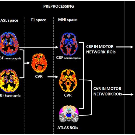 Schematic Pipeline Of The Preprocessing And Statistical Analysis