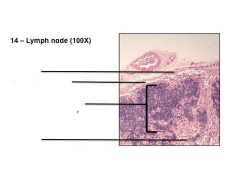 Lymph Node 100x Quiz