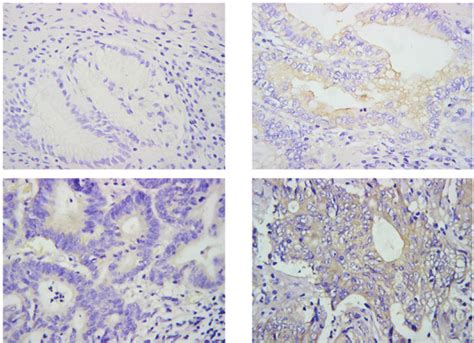 Mtor Was Mainly Distributed In The Cytoplasm A Staining Was Hardly