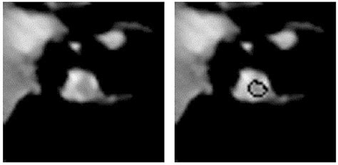 Froc Curve Of Detection Results Sensitivity Of Detection Was Adjusted