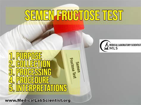 Semen Fructose Test Purpose Collection Processing Procedure Interpretations Medical