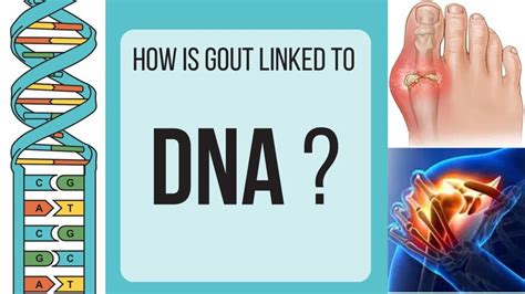 Breaking Down The Dna Of Gout Understanding The Role Of Genetics In