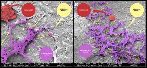 Figure 13 From Performance Of Nano Hydroxyapatitebeta Tricalcium Phosphate And Xenogenic