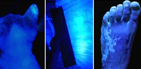 What Bacteria Glows Under Black Light Shelly Lighting