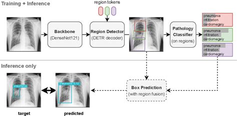 Anatomy Driven Pathology Detection On Chest X Rays