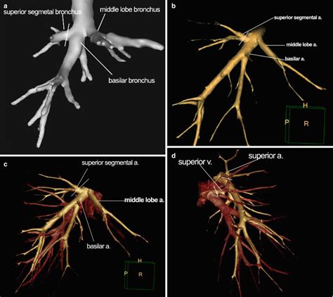 Segmentectomy Thoracic Key