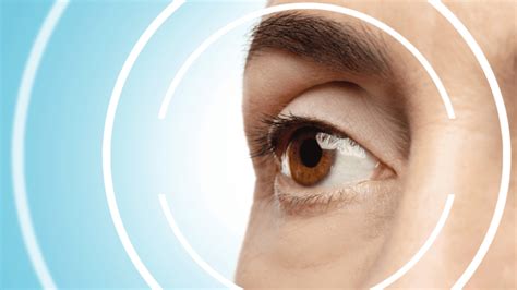 Comprehensive Guide On The Cost And Procedure Of Prk Surgery Vijaya Nethralaya