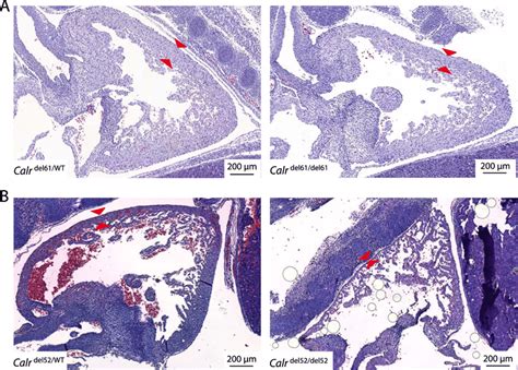 Heart Defects In Embryos Homozygous For A Type 1 Calr Mutation A Left Download Scientific