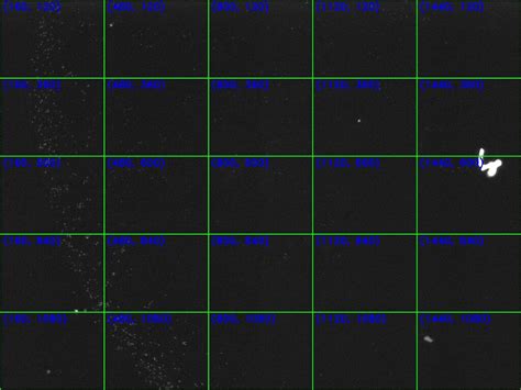Artifact Elimination In Microscopic Images Image Analysis Imagesc Forum