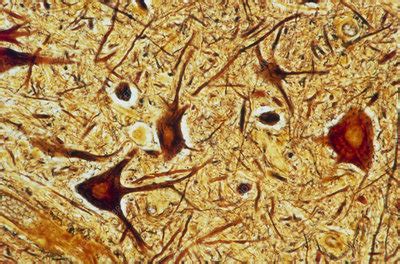 LM Of Nerve Cells In The Human Spinal Cord Stock Image P Science Photo Library