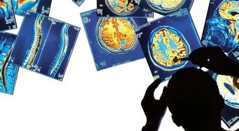 Le Cerveau Est Il Sexu Science Et Vie