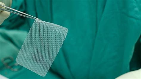 Mesh Vs No Mesh Hernia Repair Texas Hernia And Surgical Specialists