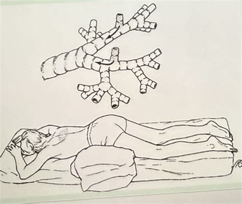 Cardiopulmonary Interventions Flashcards Quizlet