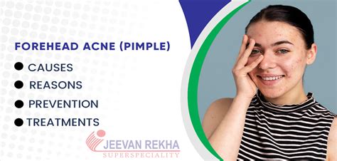 Forehead Acne Pimple Causes Reasons Treatments And Prevention