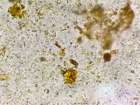 Premium Photo Stool Examination Under Light Microscopy Stool Analysis
