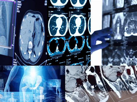 Exploring The Potential Of Dall E 2 For Ai Driven Image Generation In