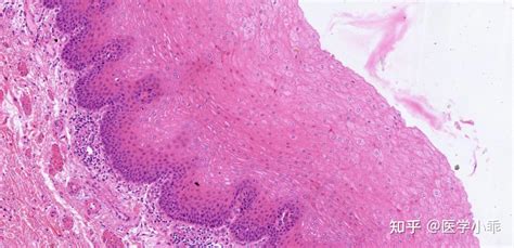 「组胚5分钟」上皮组织 知乎