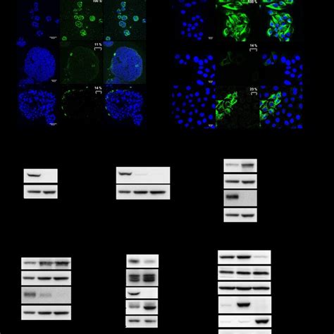 Topbp1 Oe In Mcf10a Resembles Mcf10ca1a Emt Phenotypes A Download