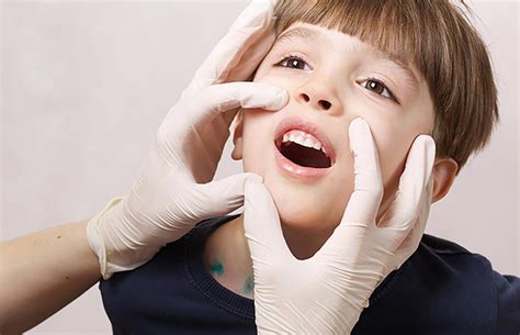5 علائم دندان آسیاب درآوردن کودکان سن دندان آسیاب کودک