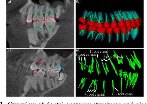 Figure 1 From Dental Anatomy Segmentation From Cone Beam Ct Images Semantic Scholar