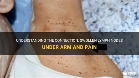 Understanding The Connection Swollen Lymph Nodes Under Arm And Pain MedShun