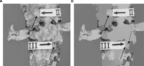 Figure 2 From An Unsupervised Strategy For Biomedical Image Segmentation Semantic Scholar