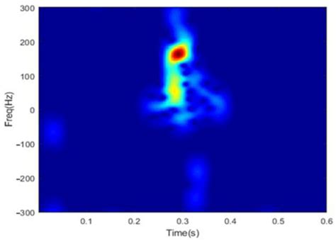 Clustering Driven Dgs Based Micro Doppler Feature Extraction For Automatic Dynamic Hand Gesture