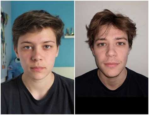 Ftm Before And After Testosterone