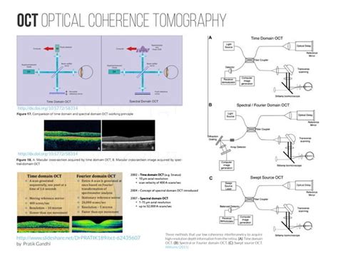Shallow Introduction For Deep Learning Retinal Image Analysis Pdf Eye And Vision Conditions