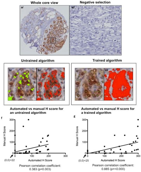 Optimizing Ariol Software For Perk Ihc Scoring A Tma Slide Download Scientific Diagram