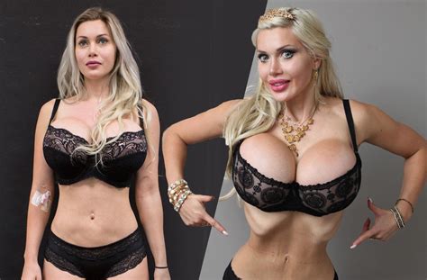Pixee Fox Undergoes Plastic Surgery And Looks Like Jessica Rabbit