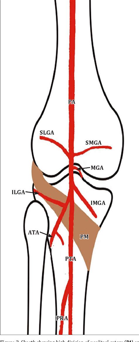Popliteal Artery Model