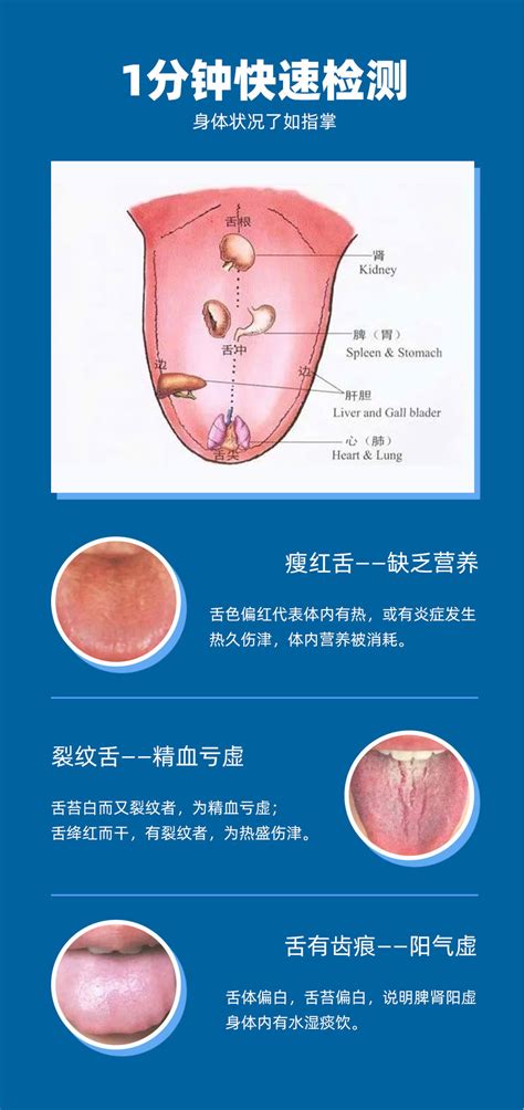 养身帮 舌诊 养身帮