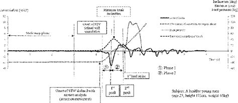 A Typical Acceleration Waveform And Definitions Of The Events From