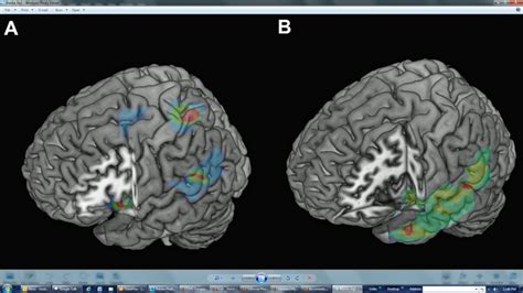 Neuroscientists Awaken Ghosts In Brain