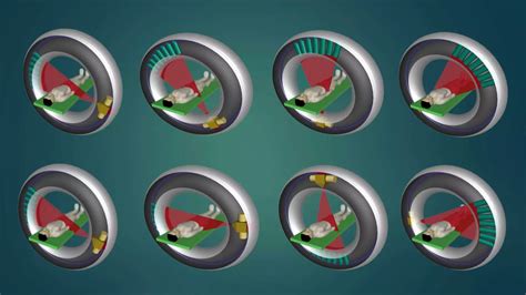 Comparison Of Ct And Cbct Pptx