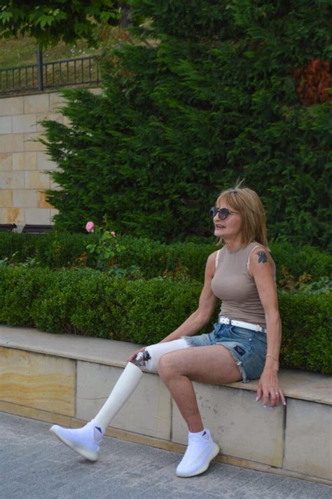 ВЦРП Здоровя Безкоштовне протезування кінцівок в Україні