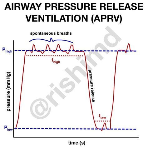 Ppt Airway Pressure Release Ventilation Aprv Powerpoint 40 Off