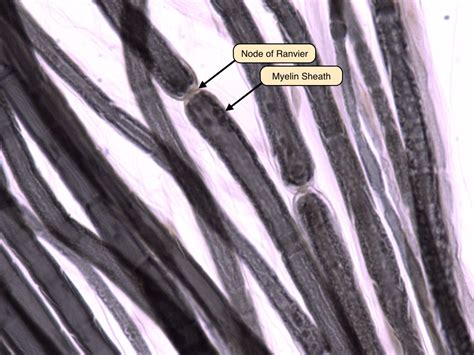 Each Schwann Cell Myelinates About 100 µm Of An Axon Gaps Between Neighboring Schwann Cells Are