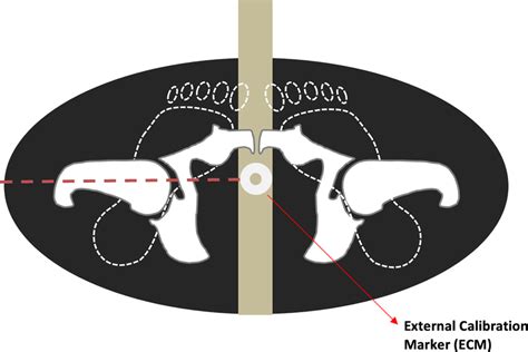 Correctly Positioned External Calibration Marker Ecm Placed Medially Download Scientific