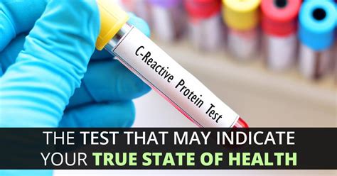 Revealing An Astonishing Correlation Between CRP Level And Inflammation